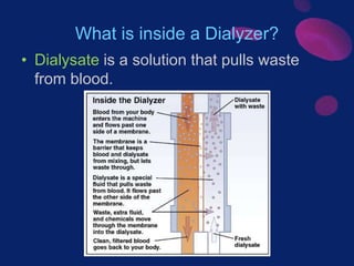 150690211-Dialysis.ppt