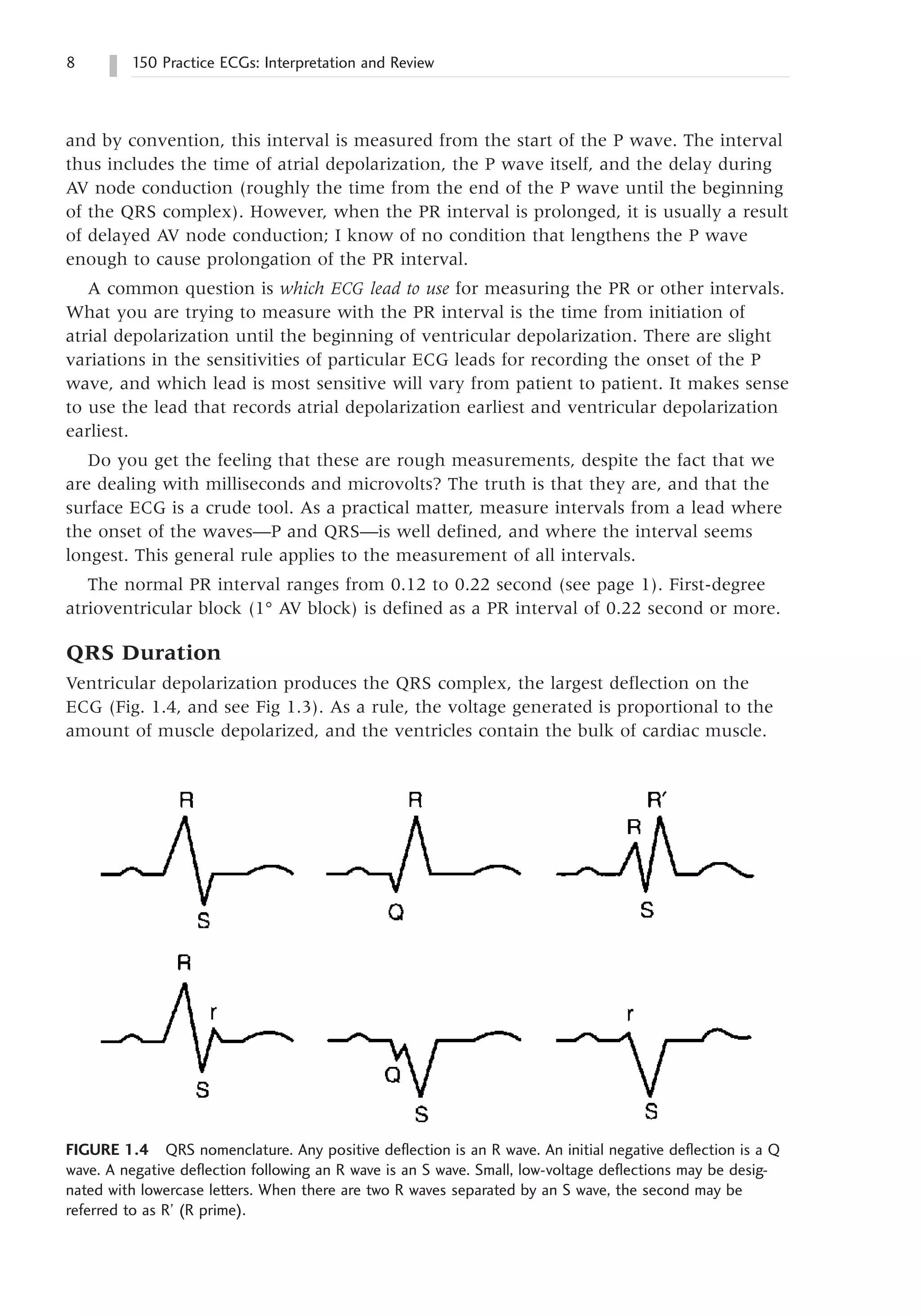 150 practice ECGs.pdf