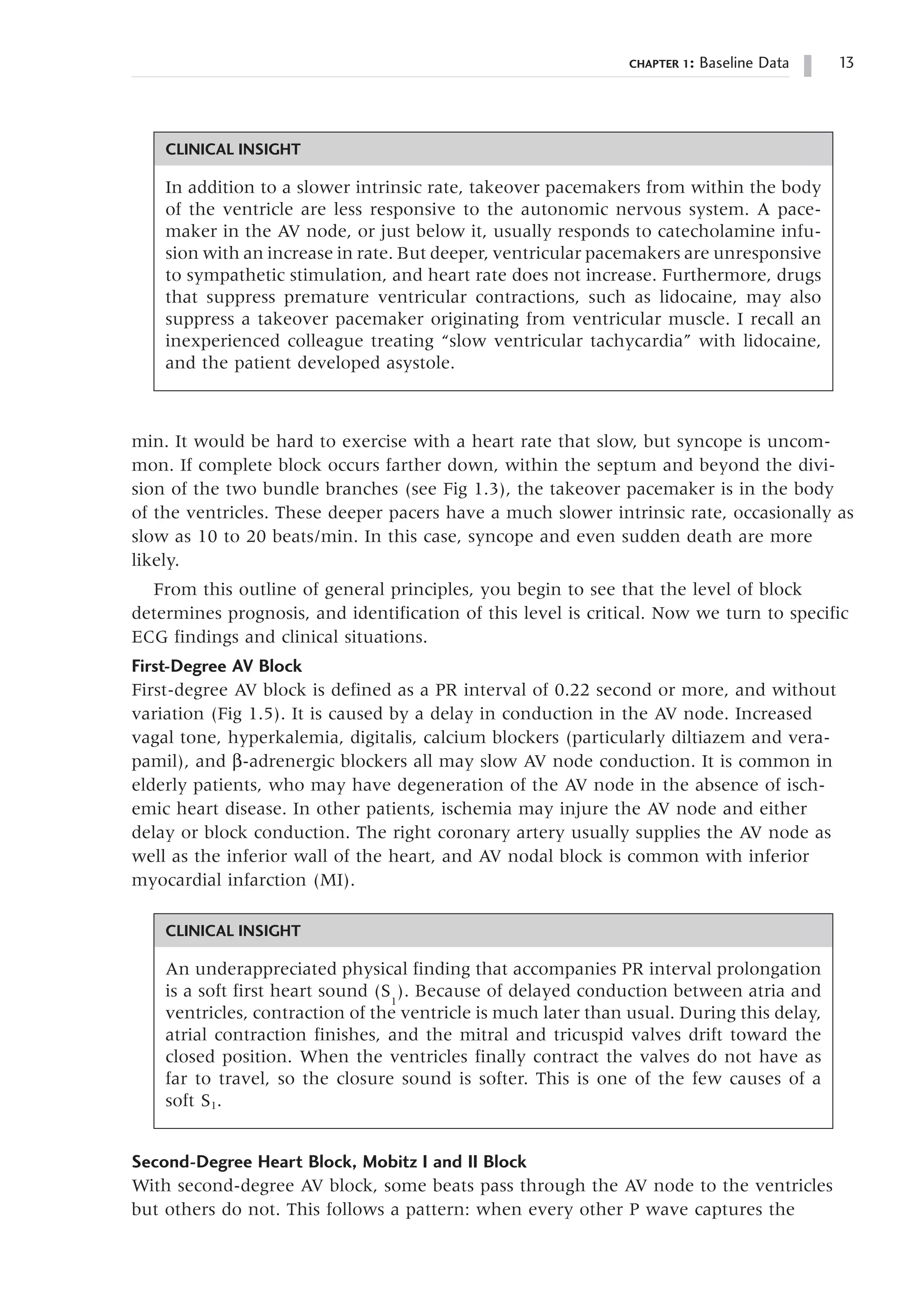 150 practice ECGs.pdf