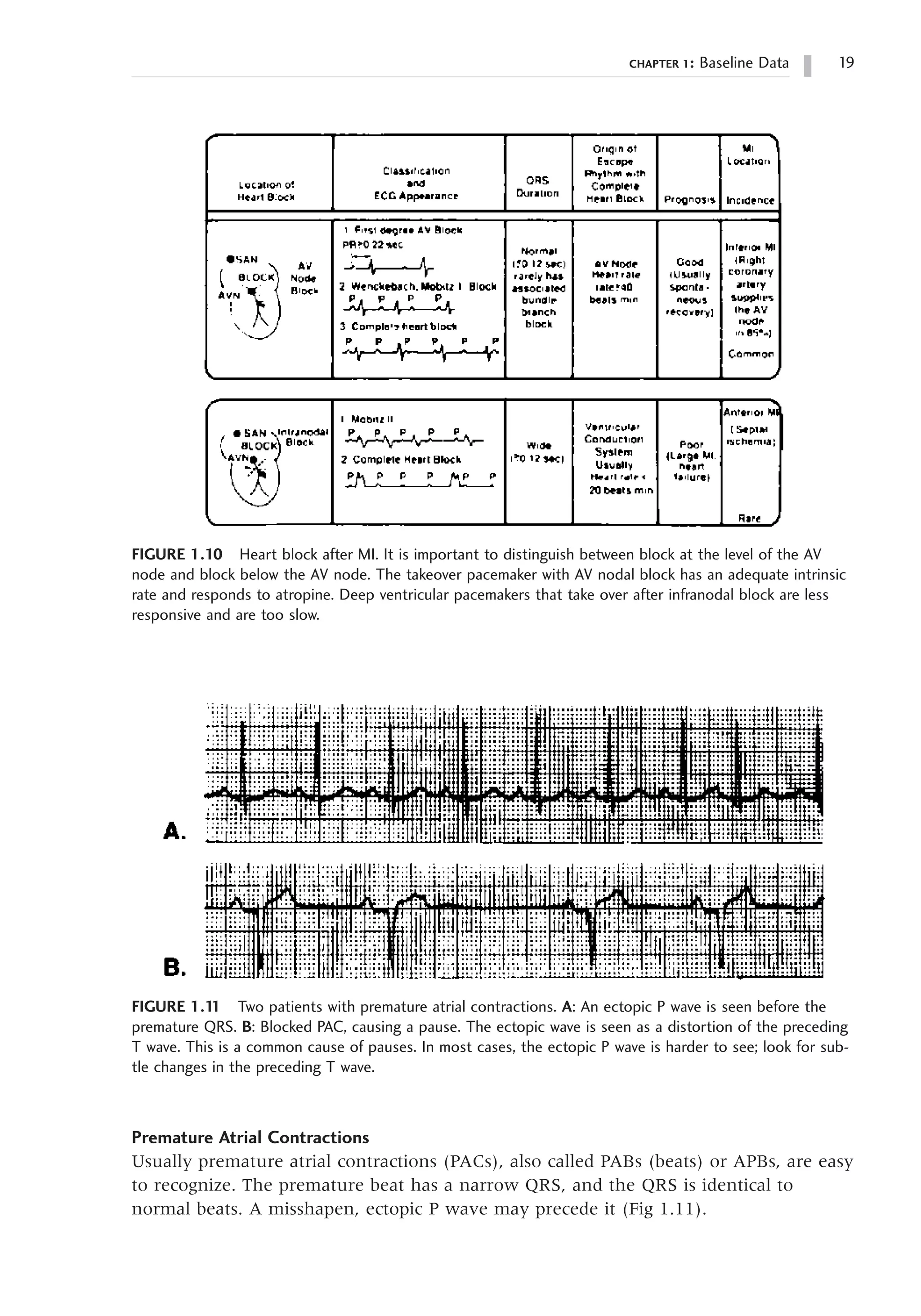 150 practice ECGs.pdf