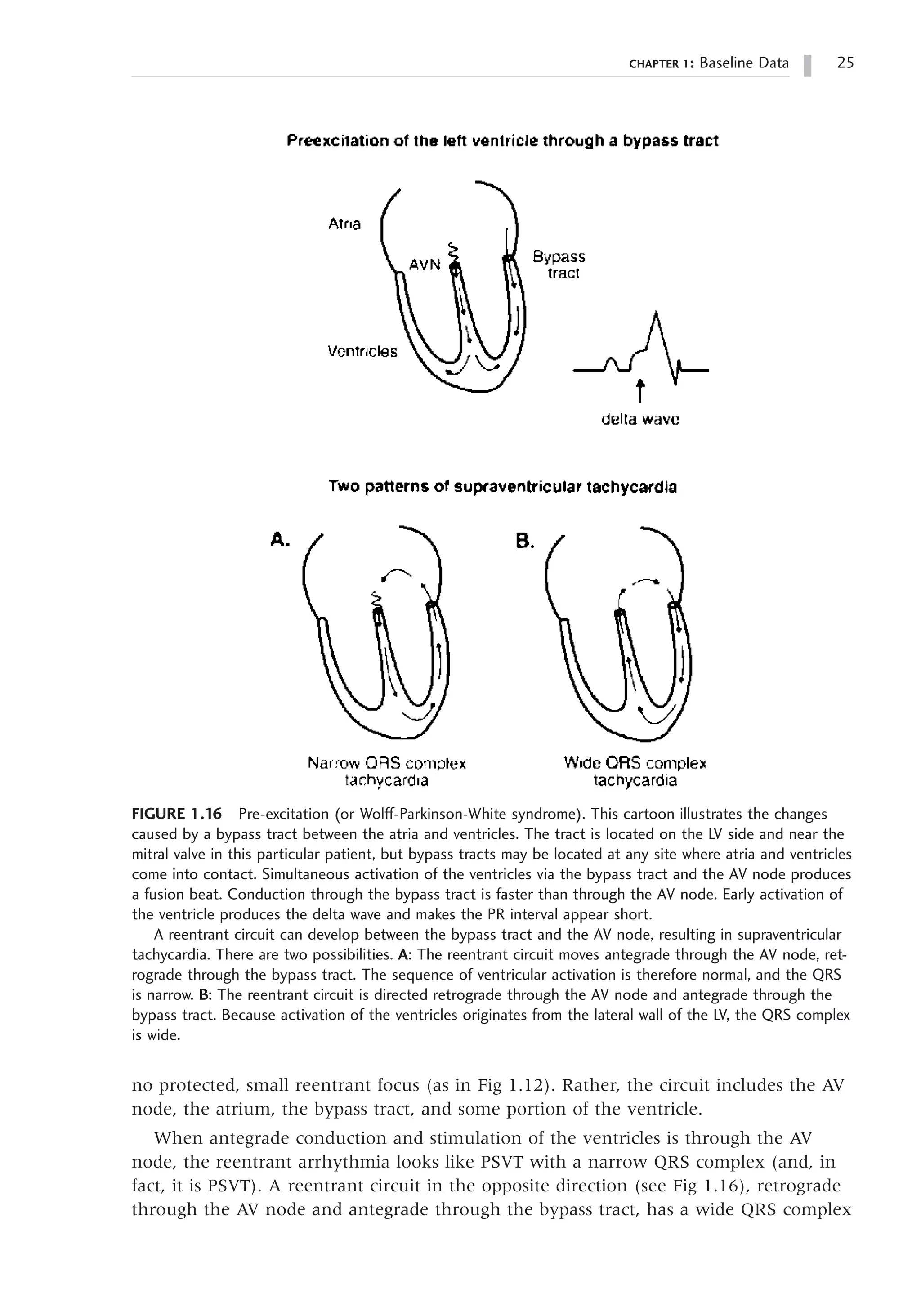 150 practice ECGs.pdf