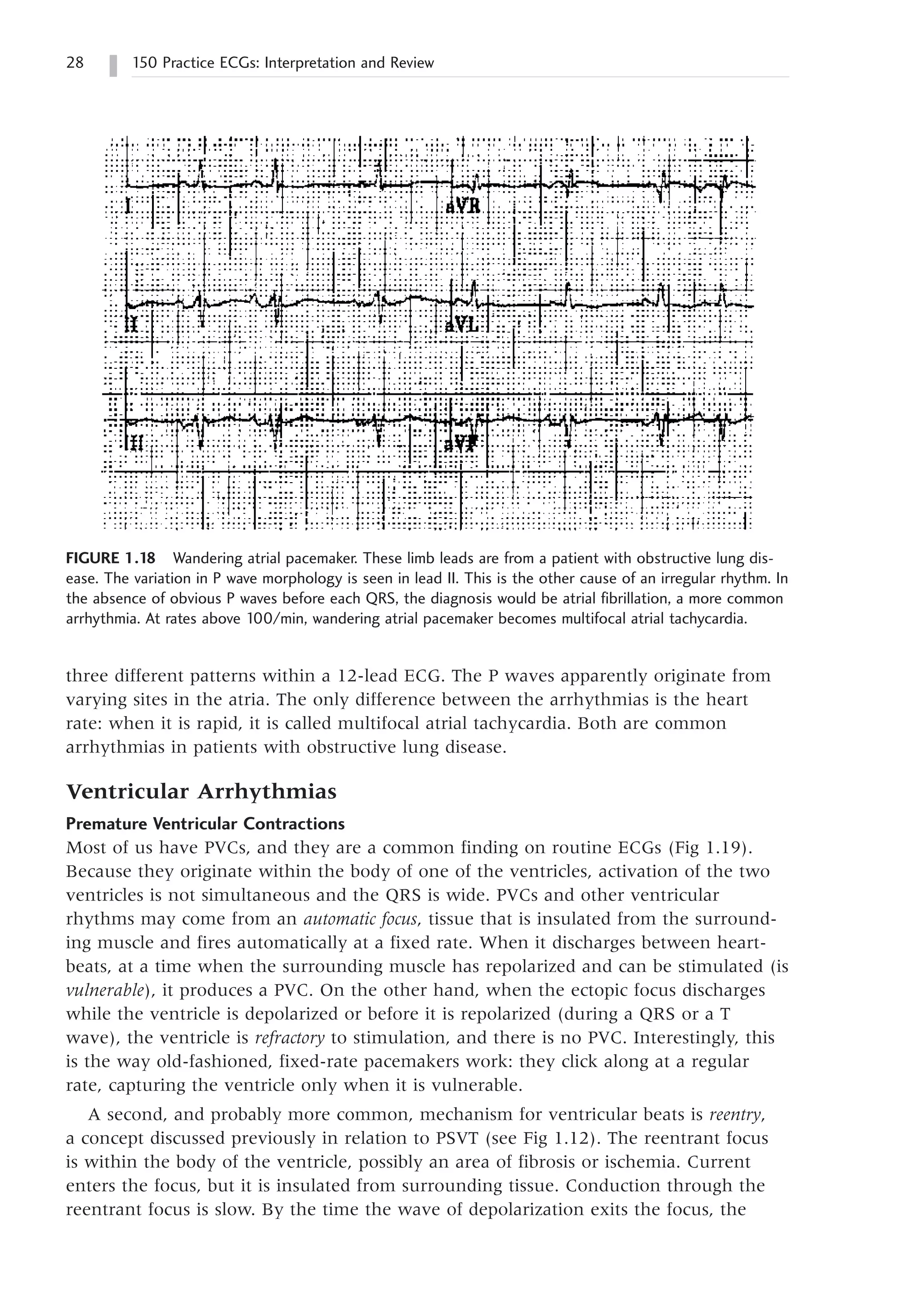 150 practice ECGs.pdf