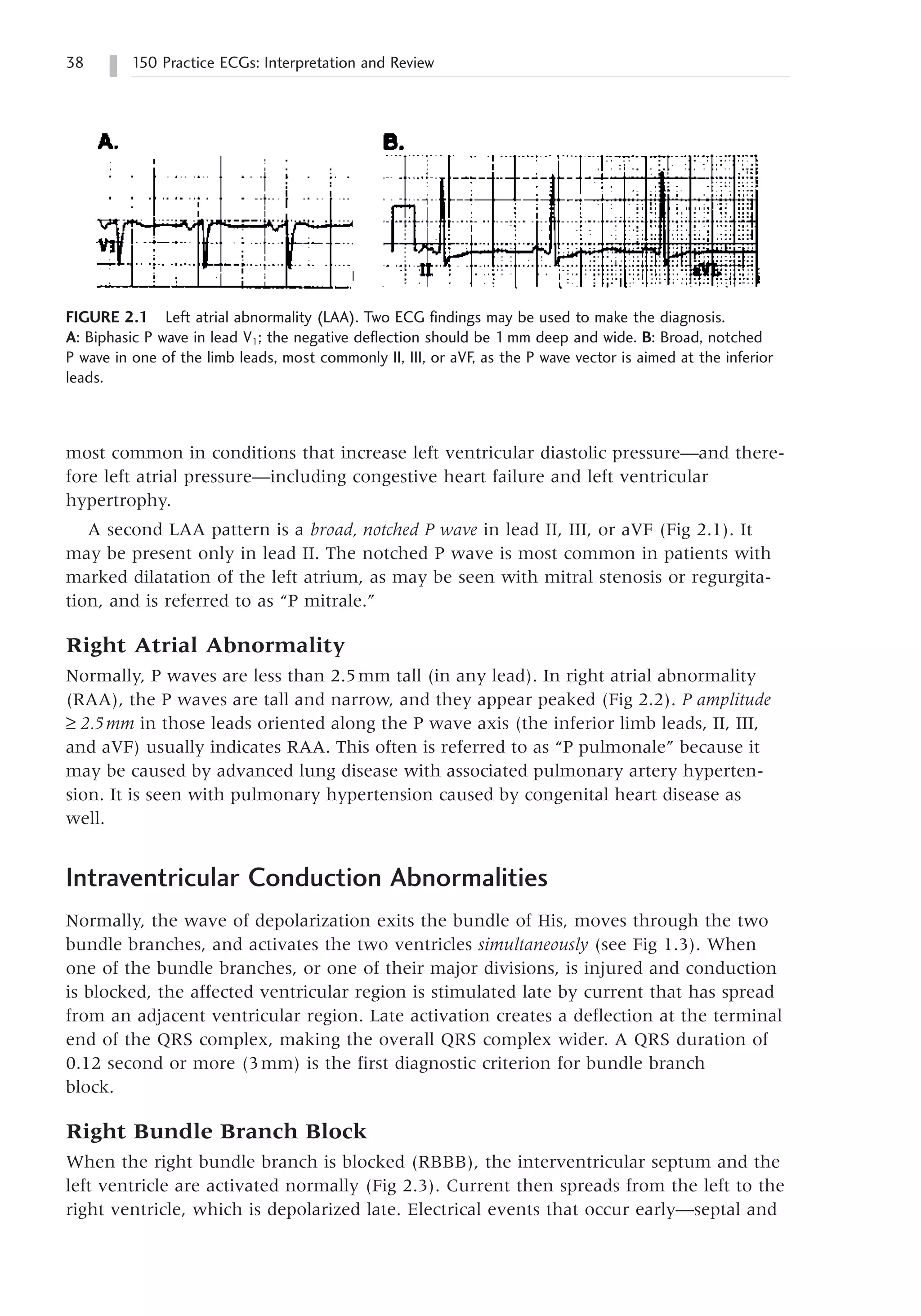 150 practice ECGs.pdf