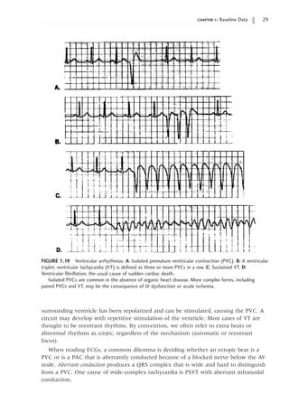 150 practice ECGs.pdf