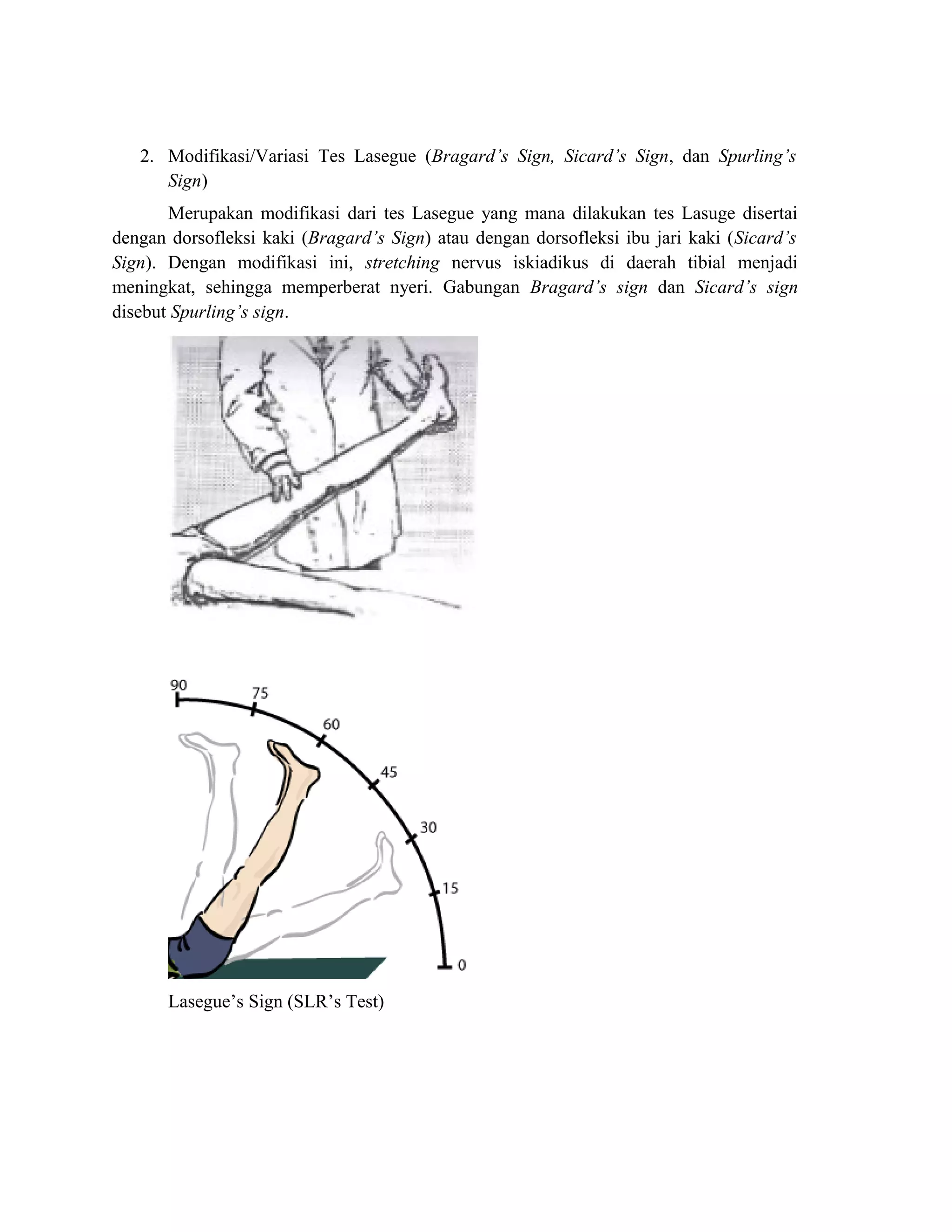 151025700 case-radikulopati-lumbal | DOC