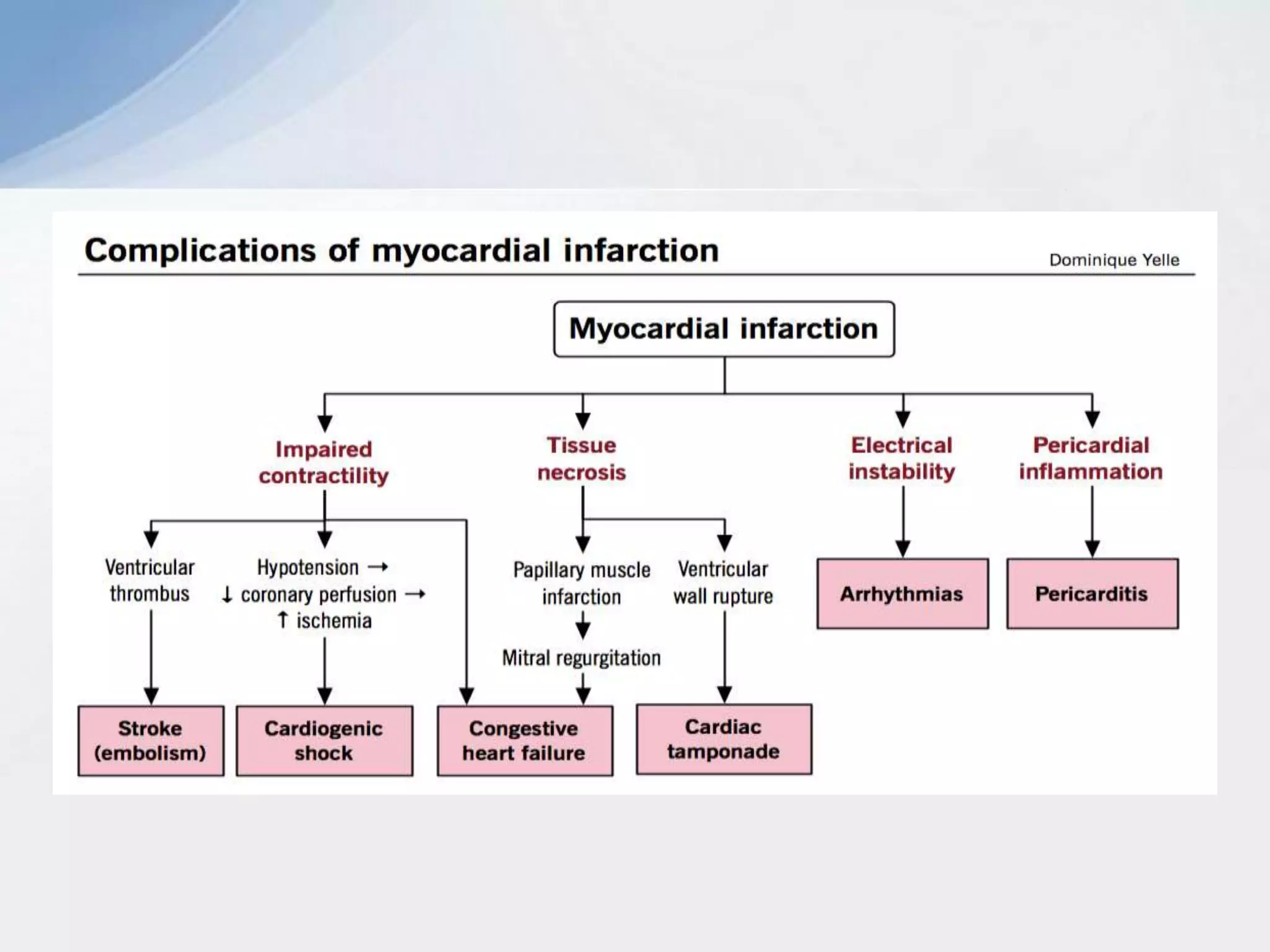 Points to Remember About Myocardial infarction | PPTX