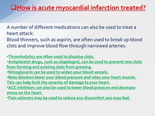 Points to Remember About Myocardial infarction | PPTX