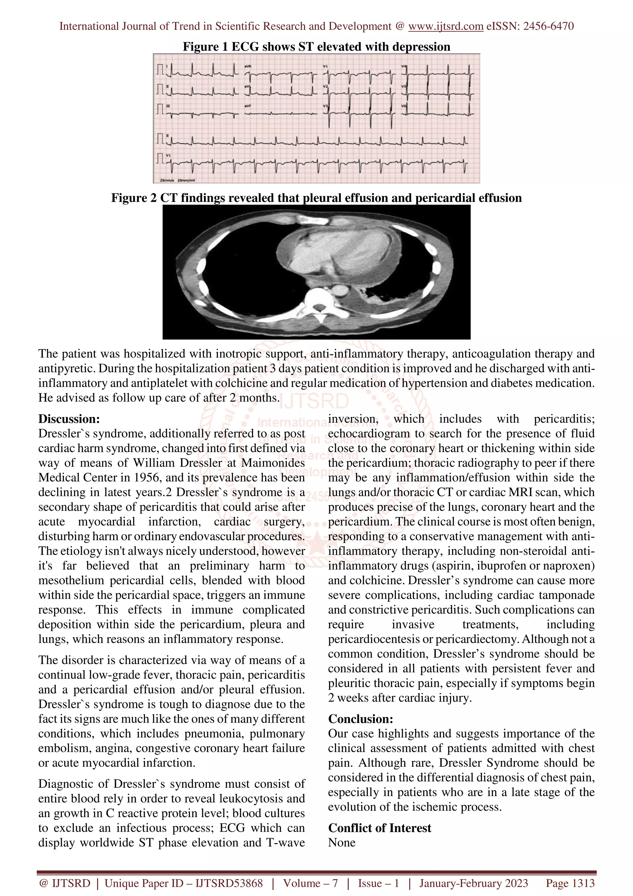 Dressler’s Syndrome Case Report | PDF