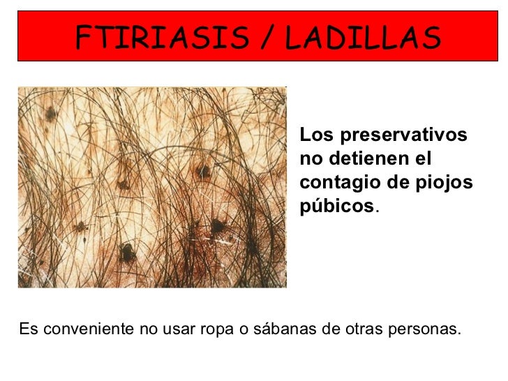 Infecciones de transmisión sexual