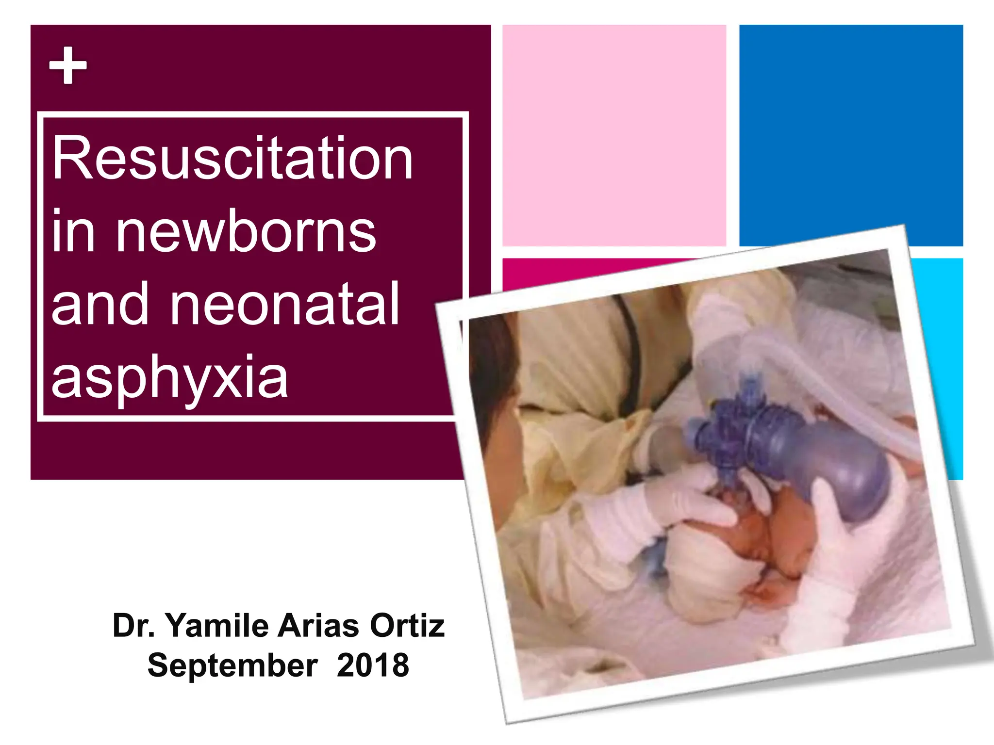 15 2018 Neonatal asphyxia and Resuscitation in newborns.ppt