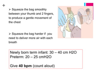15 2018 Neonatal asphyxia and Resuscitation in newborns.ppt