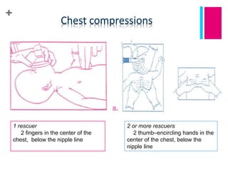 15 2018 Neonatal asphyxia and Resuscitation in newborns.ppt
