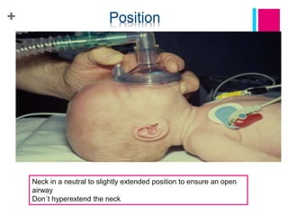 15 2018 Neonatal asphyxia and Resuscitation in newborns.ppt