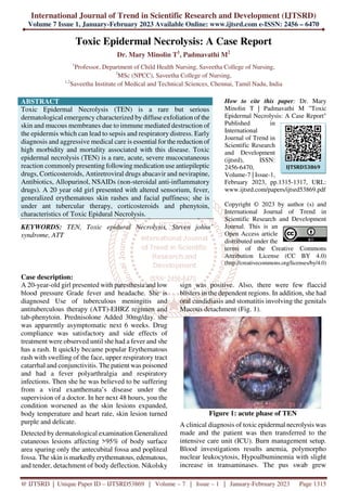 Toxic Epidermal Necrolysis A Case Report | PDF