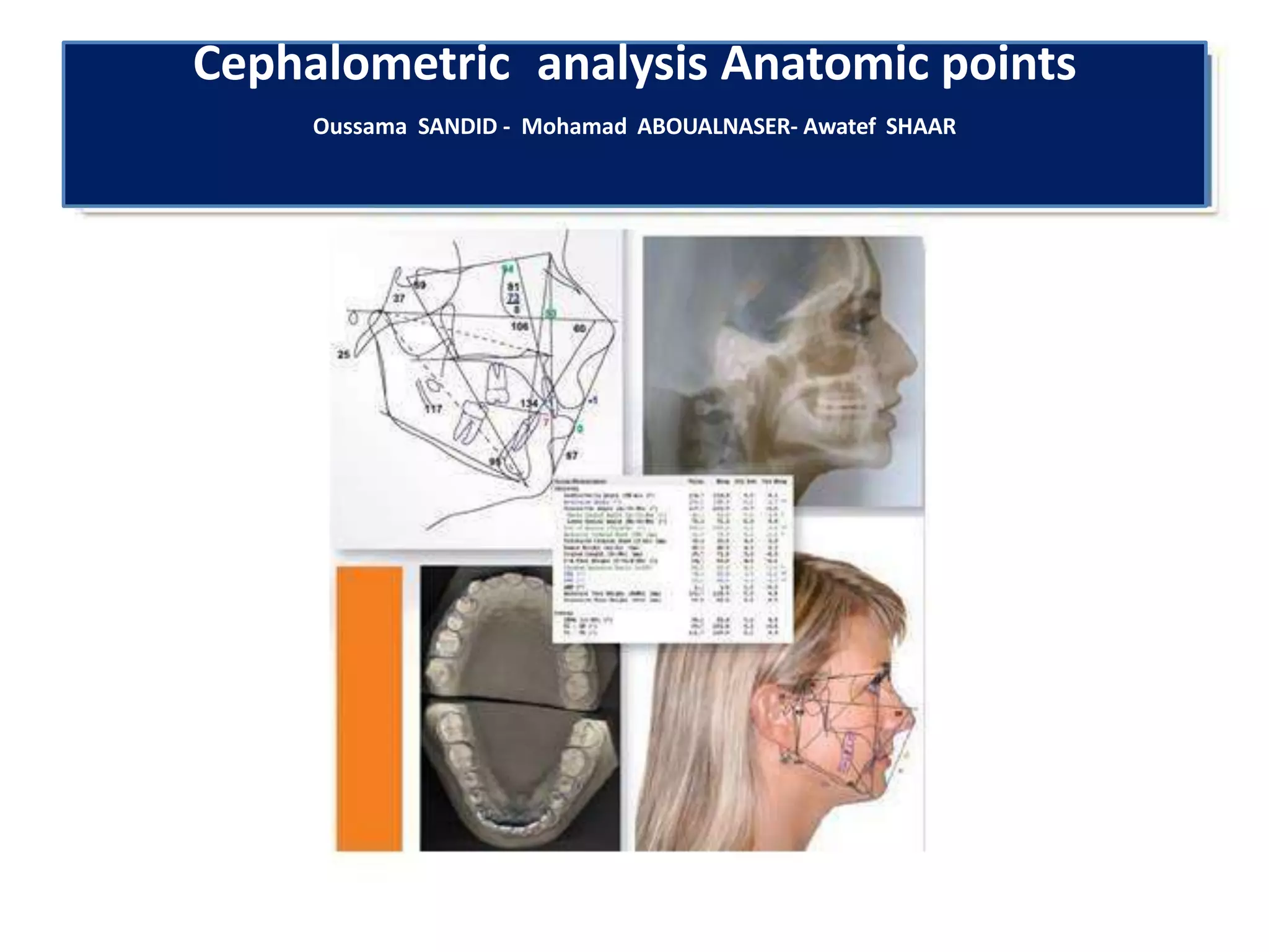 153 cephalometric analysis-anatomic points- analyses cephalometriques ...