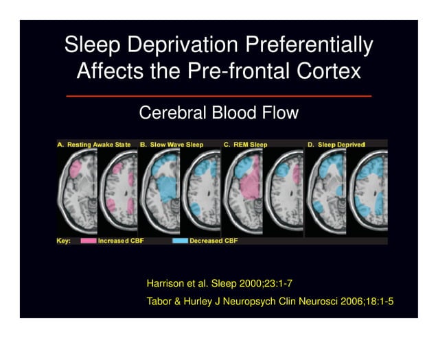Sleep in the ICU The Next Delirium Frontier? | PDF | Sleep Disorders ...