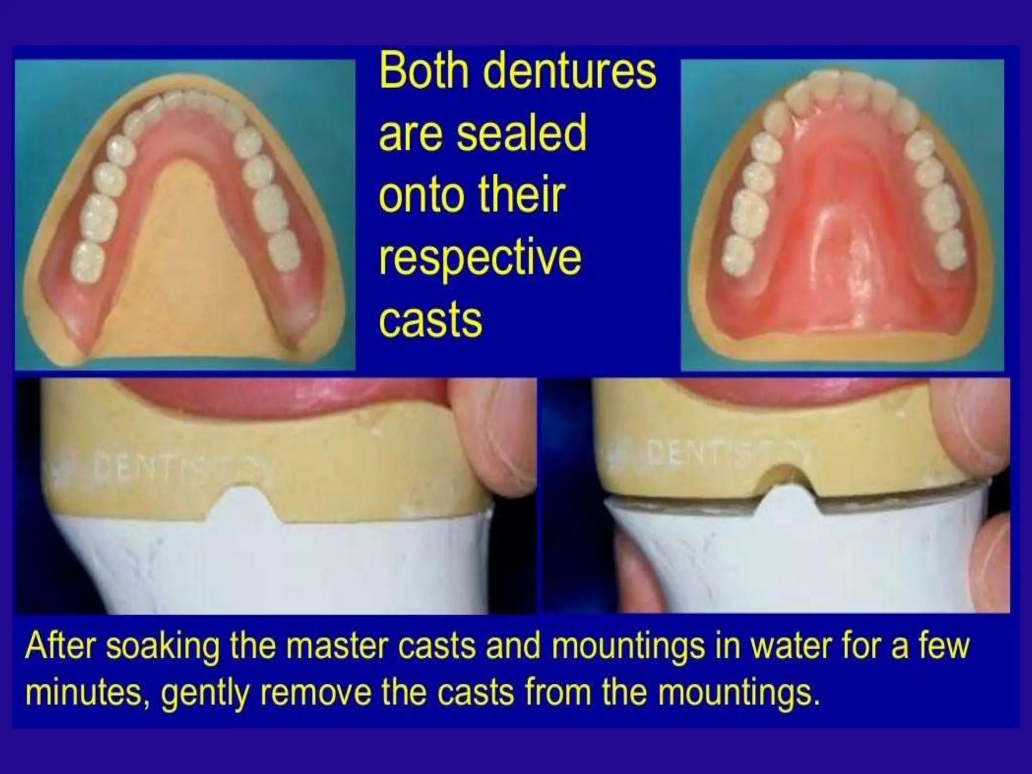 Processing of Complete denture prosthodontics.pptx