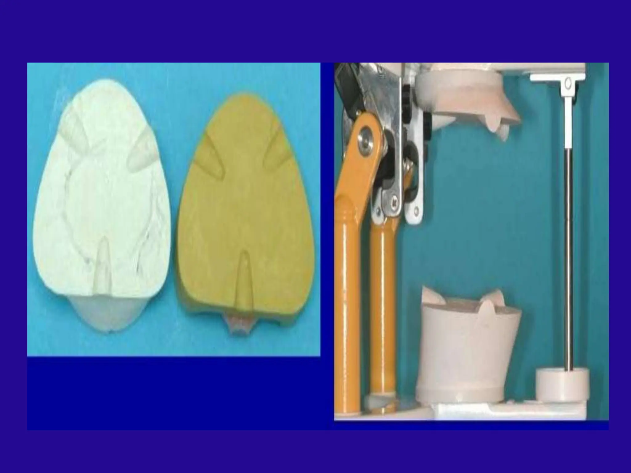 Processing of Complete denture prosthodontics.pptx