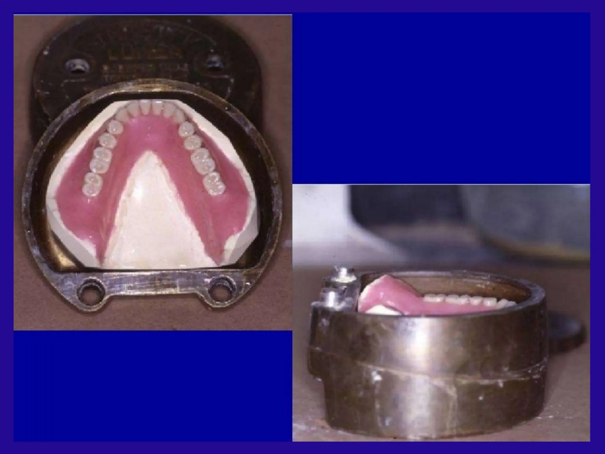 Processing of Complete denture prosthodontics.pptx
