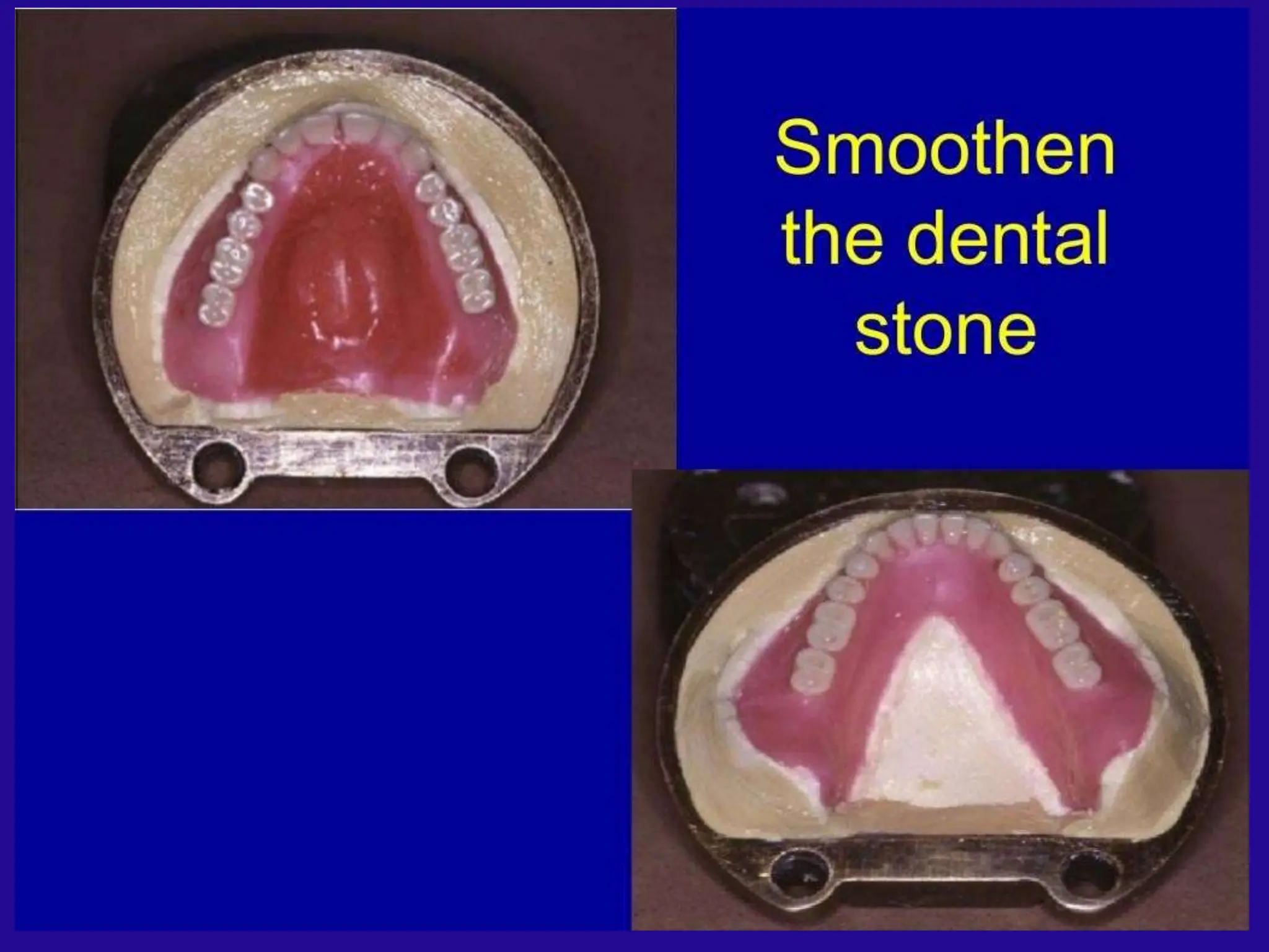 Processing of Complete denture prosthodontics.pptx