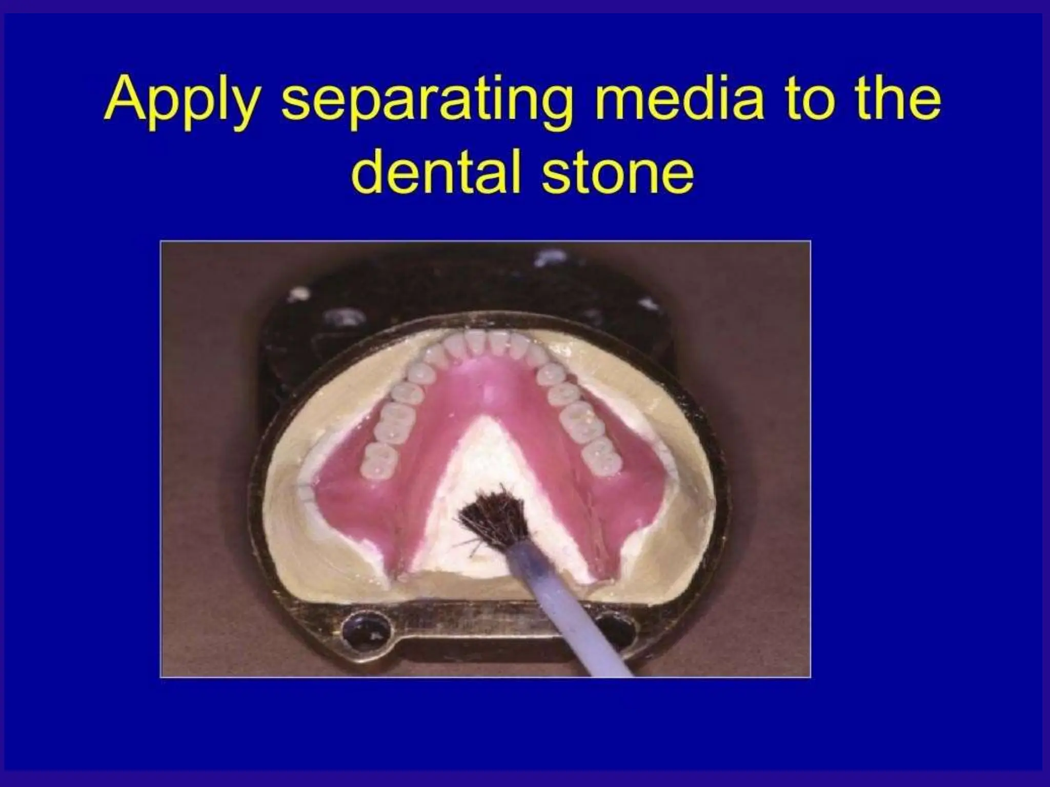 Processing of Complete denture prosthodontics.pptx