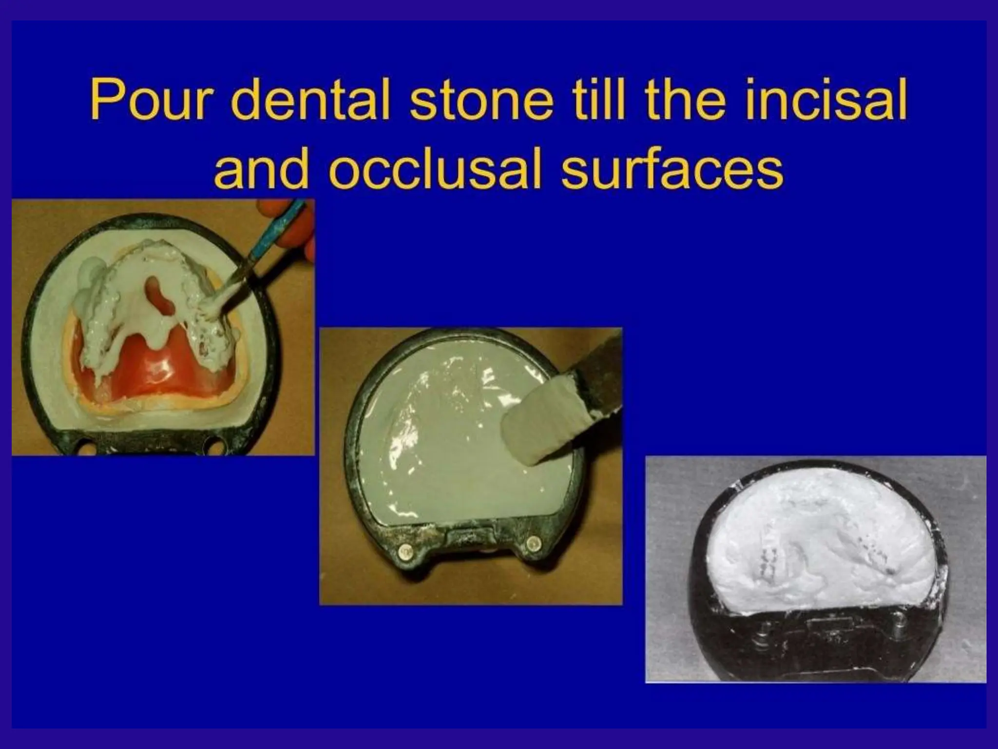 Processing of Complete denture prosthodontics.pptx