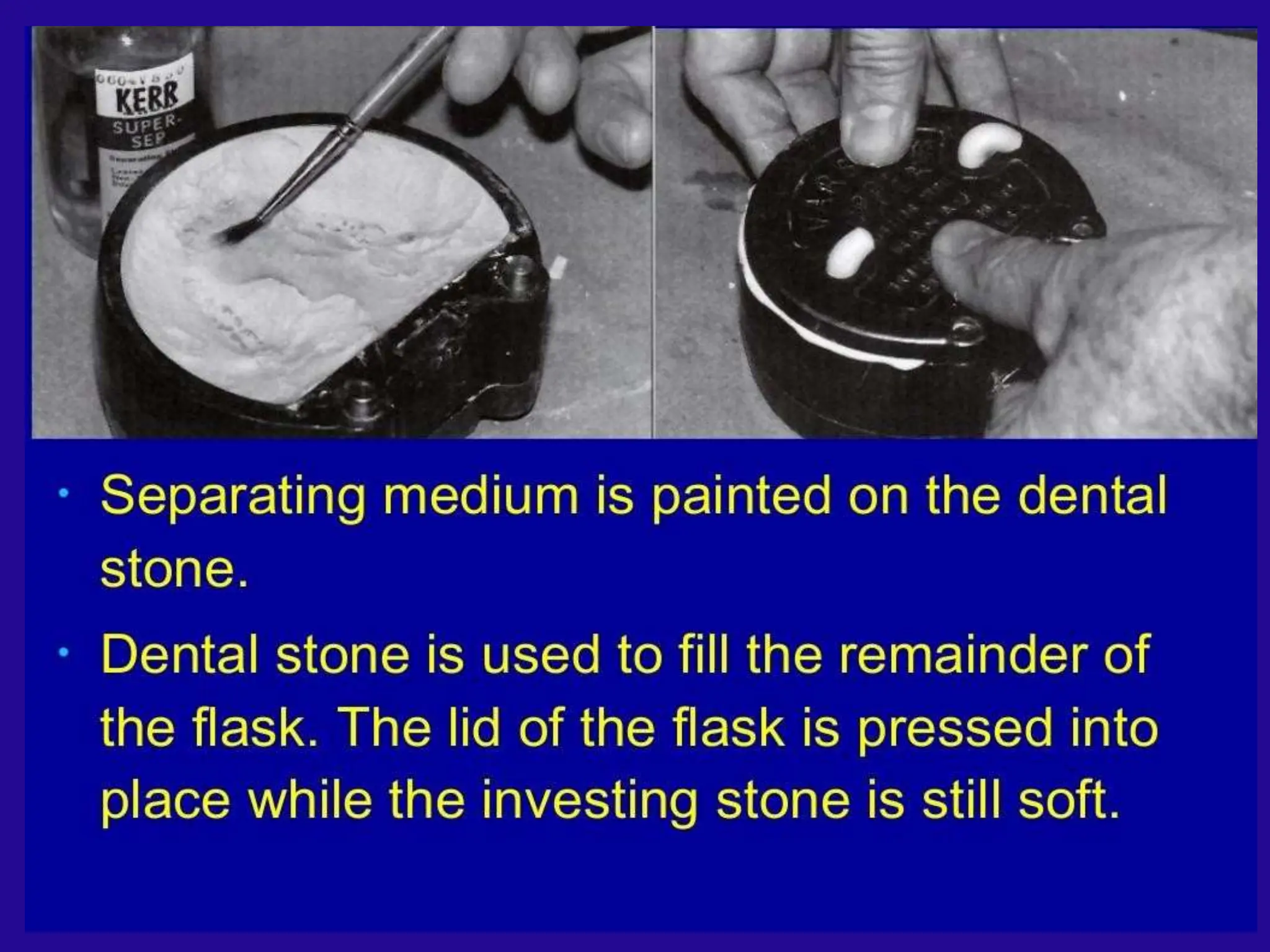 Processing of Complete denture prosthodontics.pptx