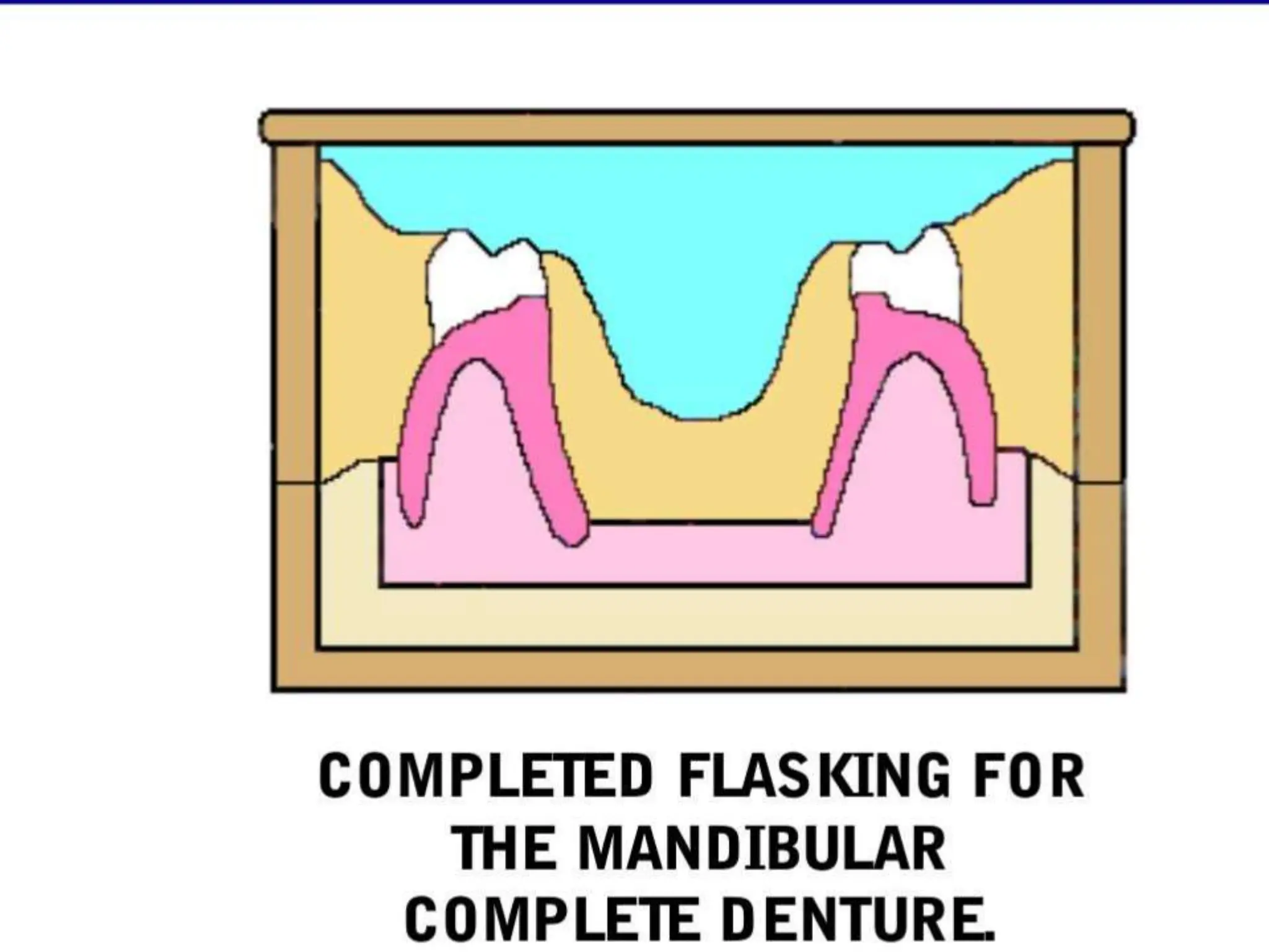 Processing of Complete denture prosthodontics.pptx