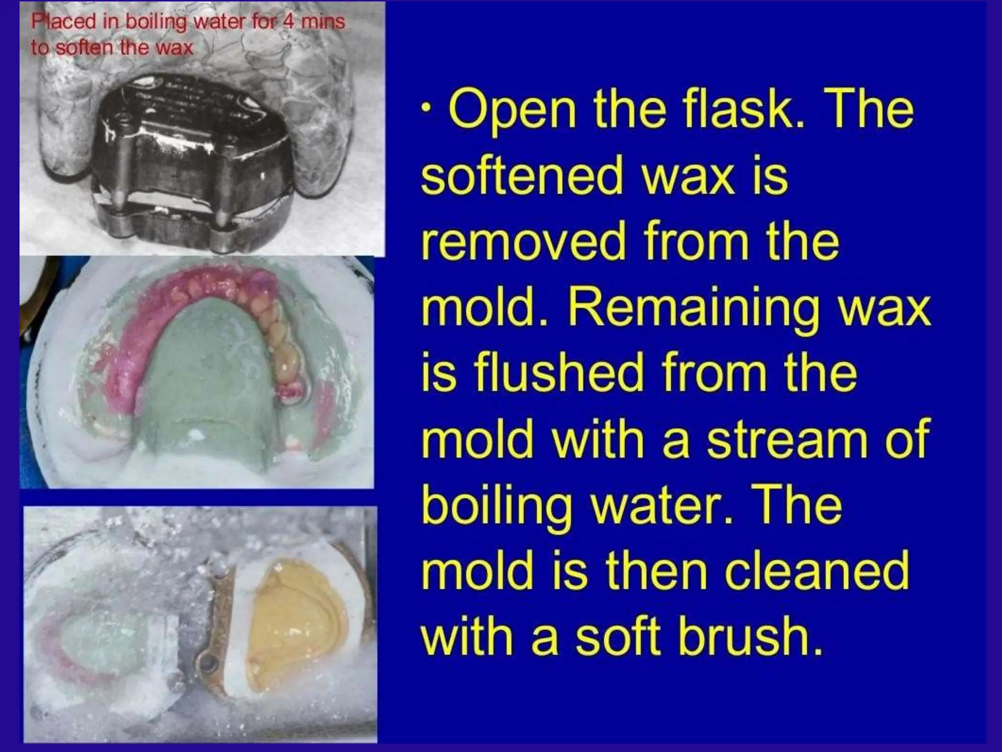 Processing of Complete denture prosthodontics.pptx