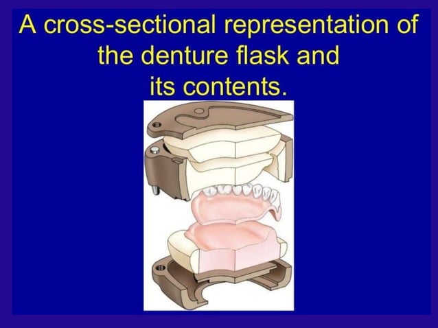 Processing of Complete denture prosthodontics.pptx