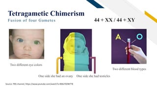 Tetragametic Chimerism