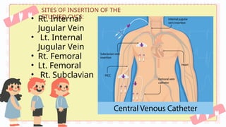 Central venous catheter (CVC) cannulations are associated with ...