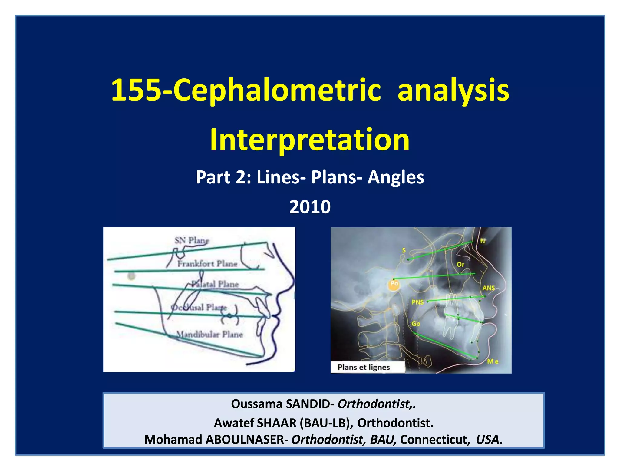 155 interpretation of cephalometric data-cepahalometric analysis ...