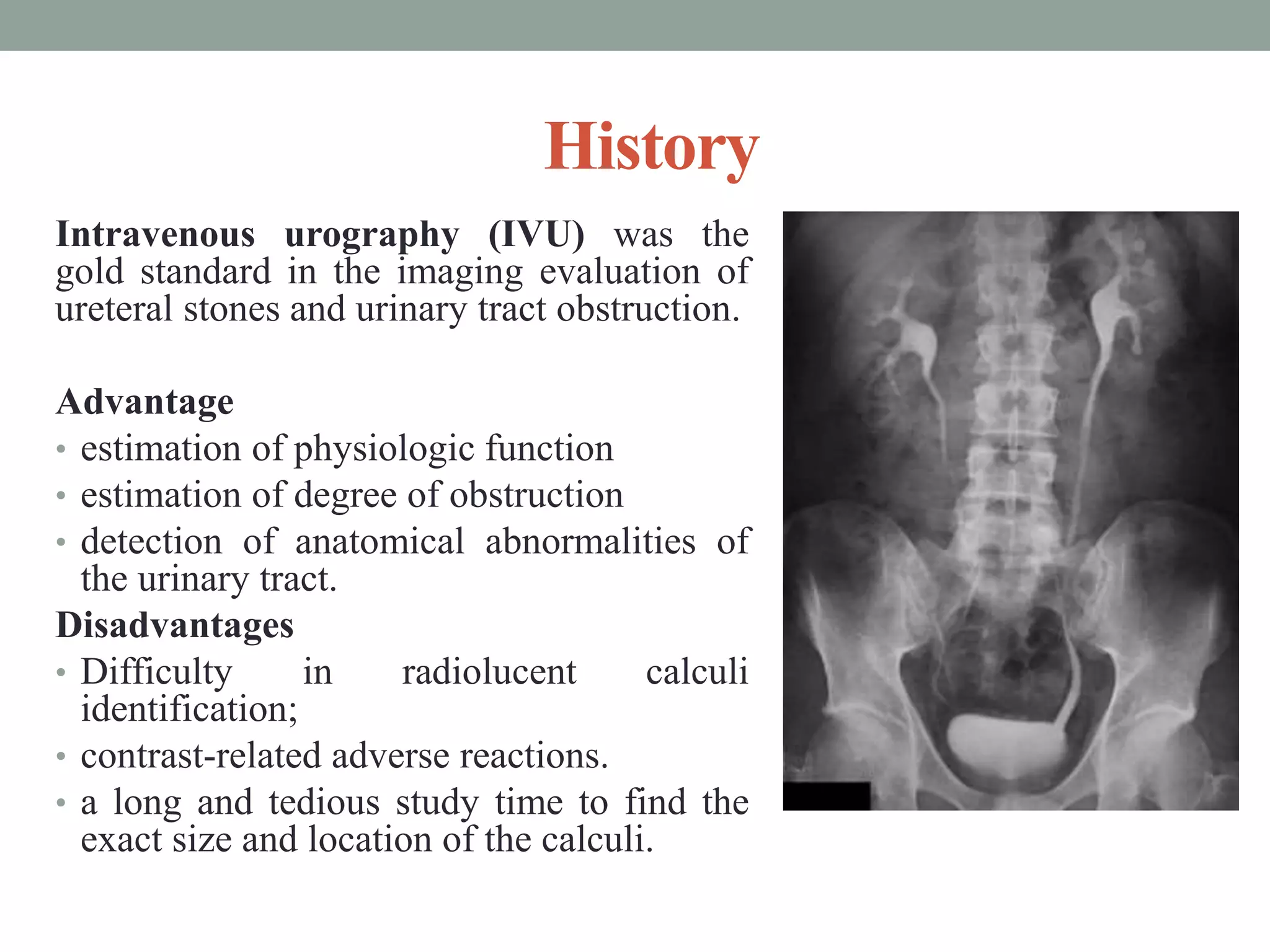 CT urography | PPTX