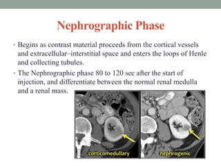 CT urography | PPTX