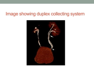 CT urography | PPTX