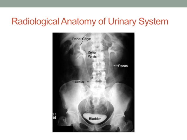 CT urography | PPTX | Digestive Disorders | Diseases and Conditions