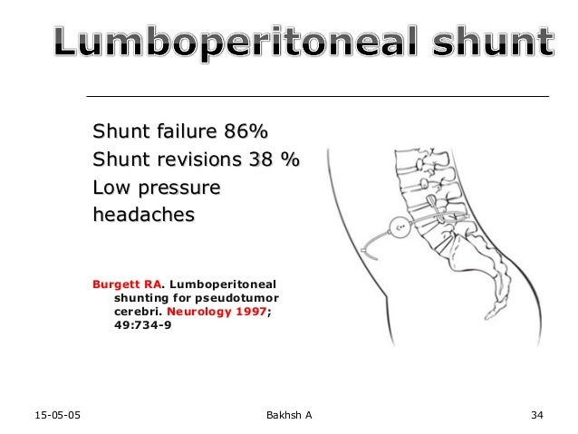 Management of pseudotumor cerebri