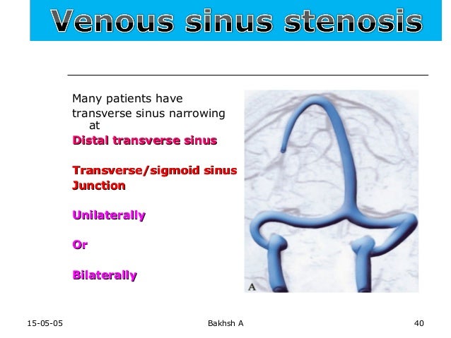 Management of pseudotumor cerebri