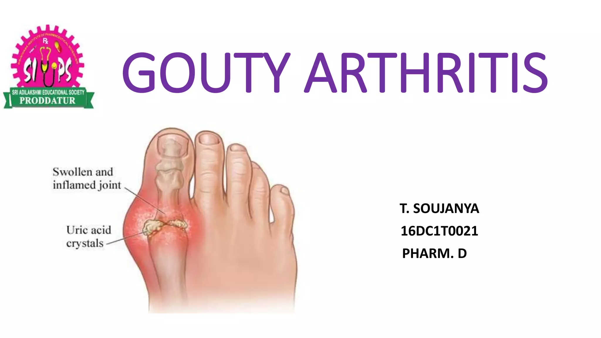 Pathophysiology and clinical management of gouty arthritis | PPTX