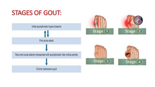 Pathophysiology and clinical management of gouty arthritis | PPTX