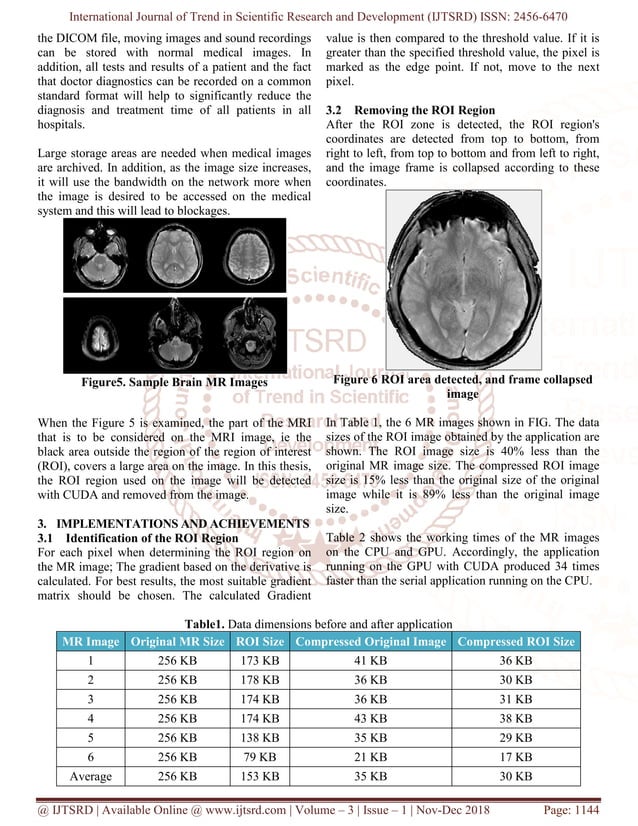 Compressing of Magnetic Resonance Images with Cuda | PDF
