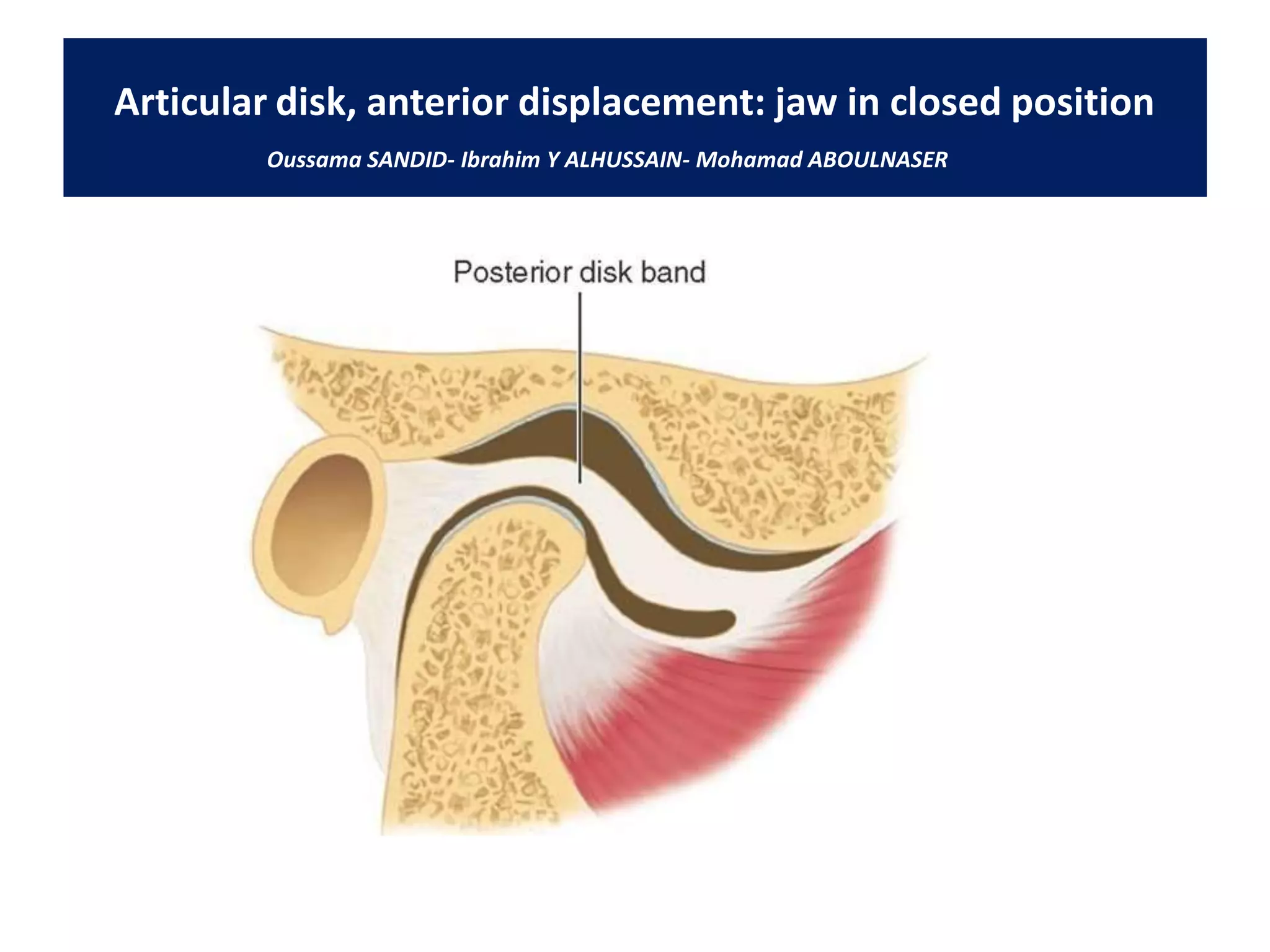157 temporomandibular joint-tmj- anatomy | PDF | Death, Injury, or ...