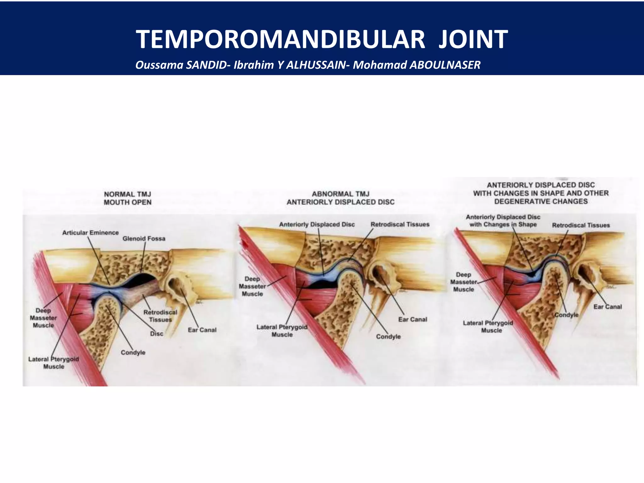 157 temporomandibular joint-tmj- anatomy | PPT