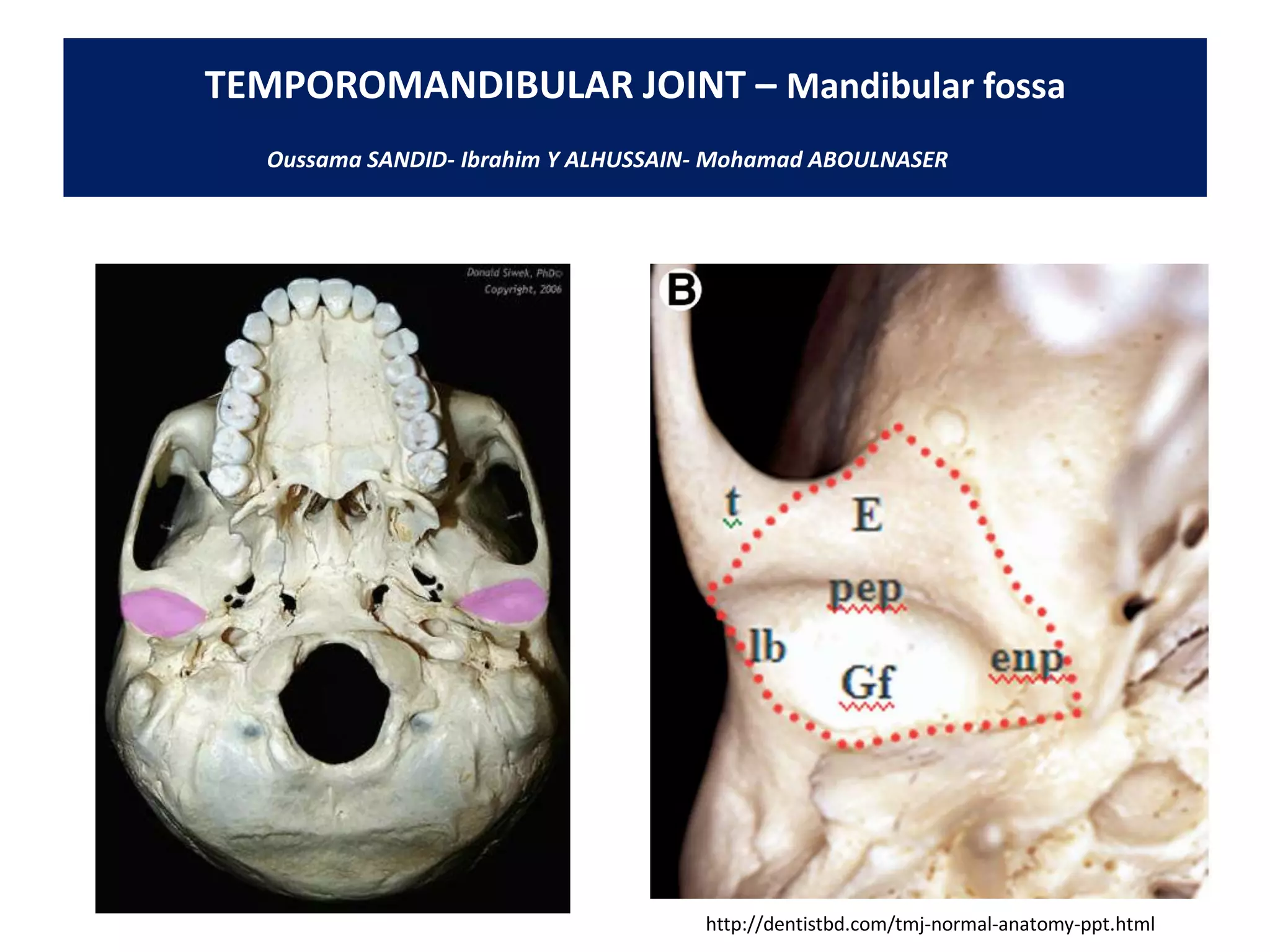 157 temporomandibular joint-tmj- anatomy | PPT