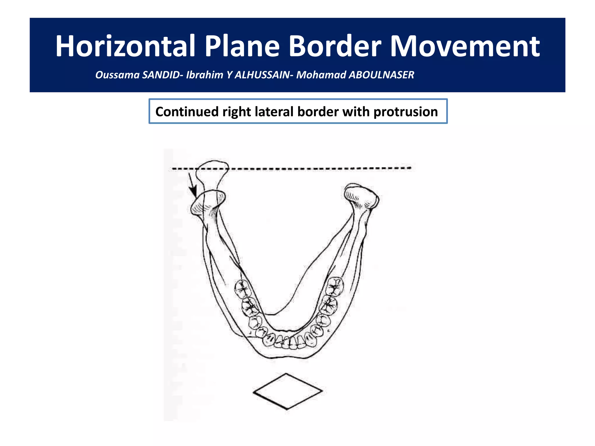 157 temporomandibular joint-tmj- anatomy mechanichs | PDF