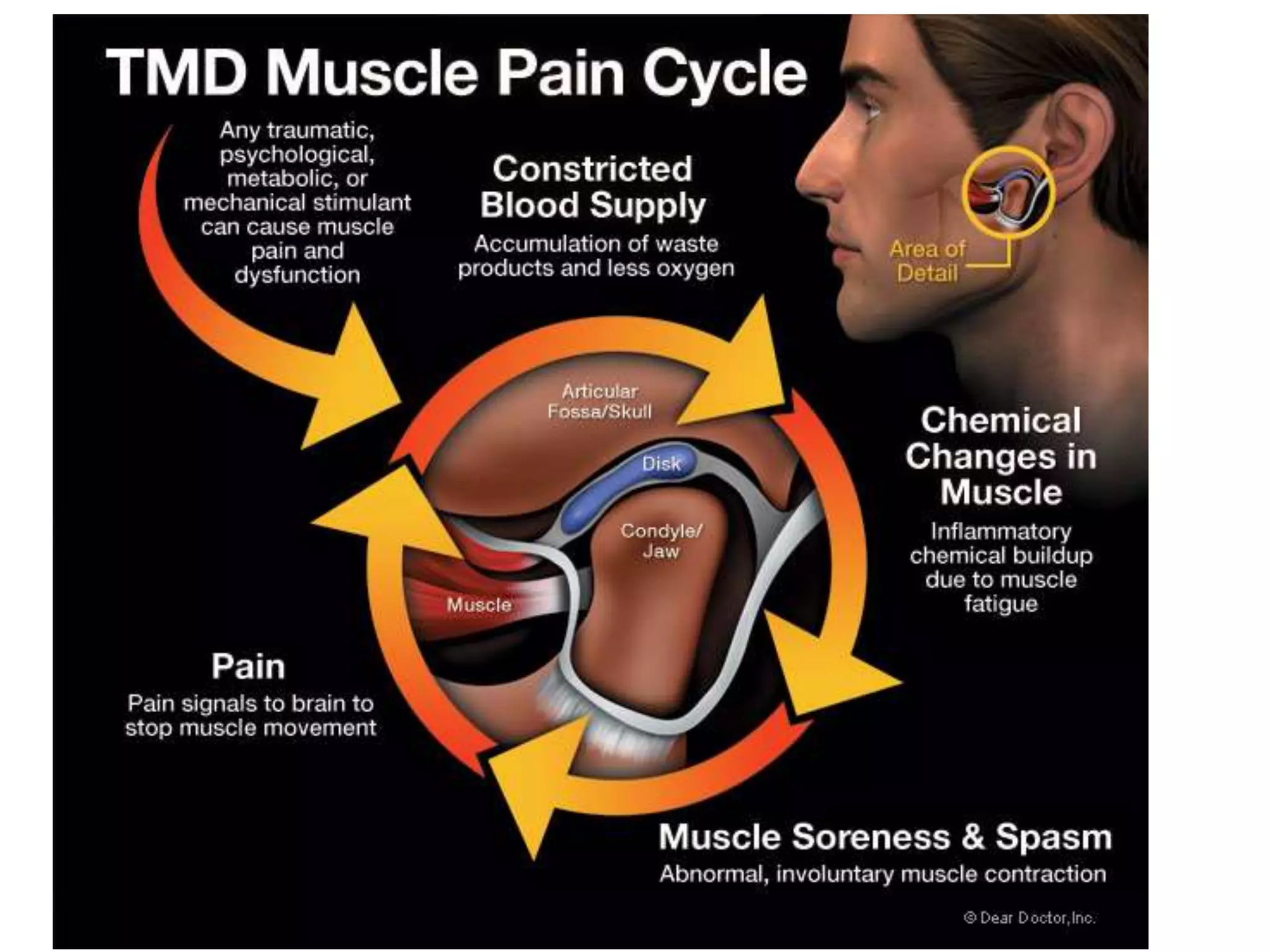 157 temporomandibular joint-tmj- anatomy mechanichs | PDF