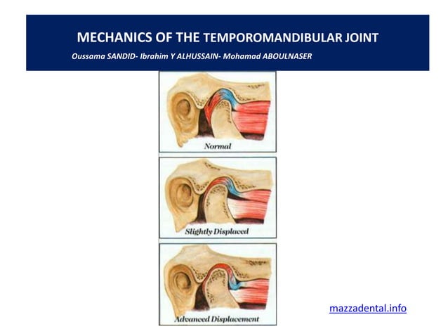 157 temporomandibular joint-tmj- anatomy mechanichs | PDF