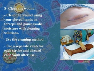 wound dressing..its al about how to do dressing in a wound area | PPT
