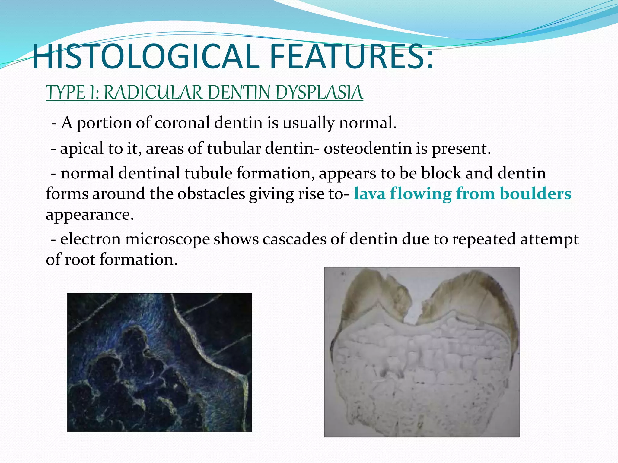 structural anomalies of teeth | PPTX